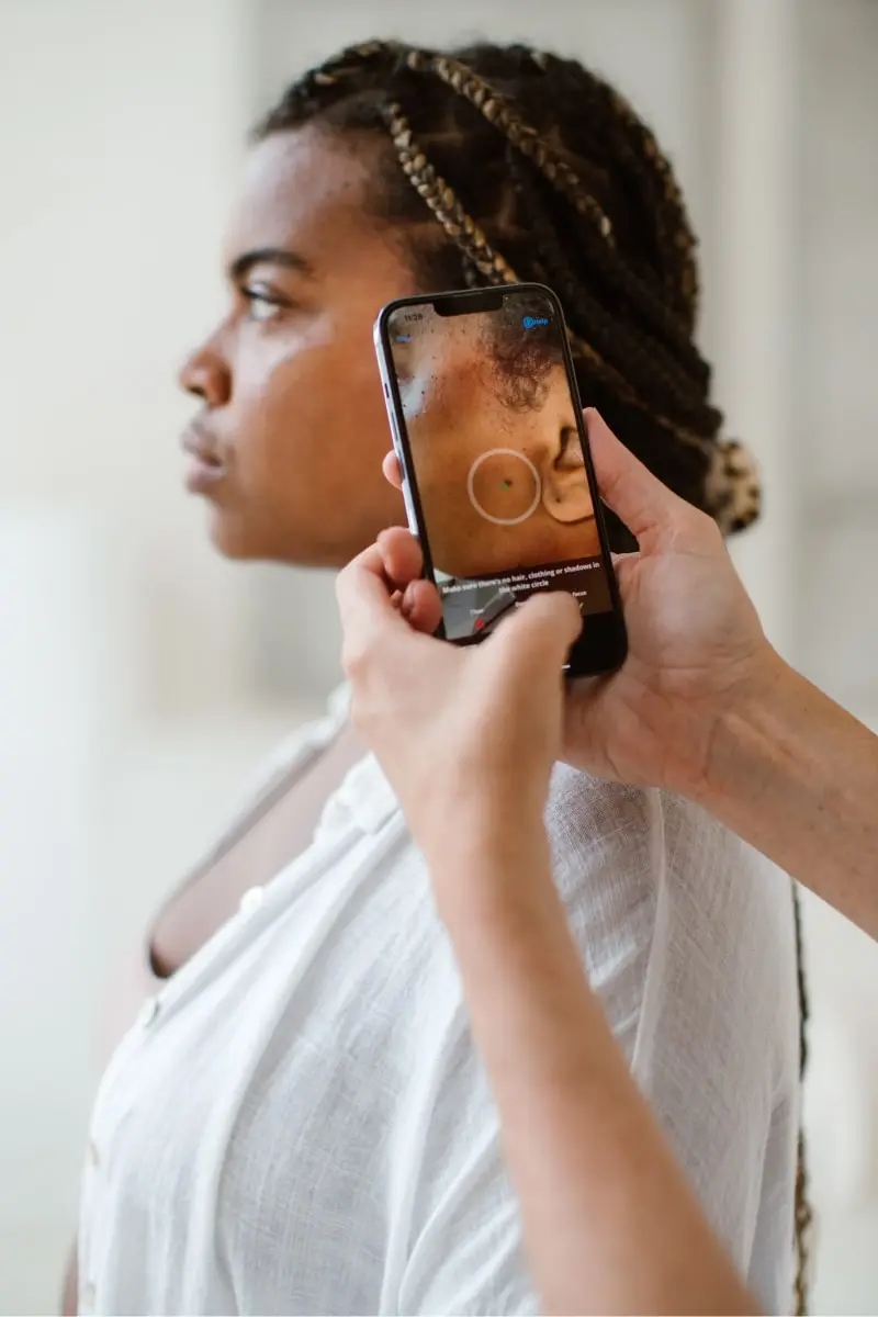SkinVision | Huidkanker Melanoom Detectie App