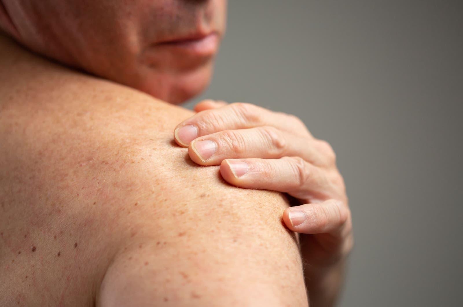 How skin cancer affects the body | 3 main types